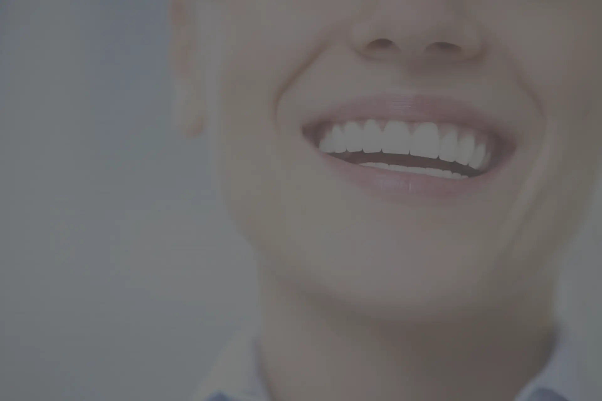 Best At-Home Teeth Whitening Kits